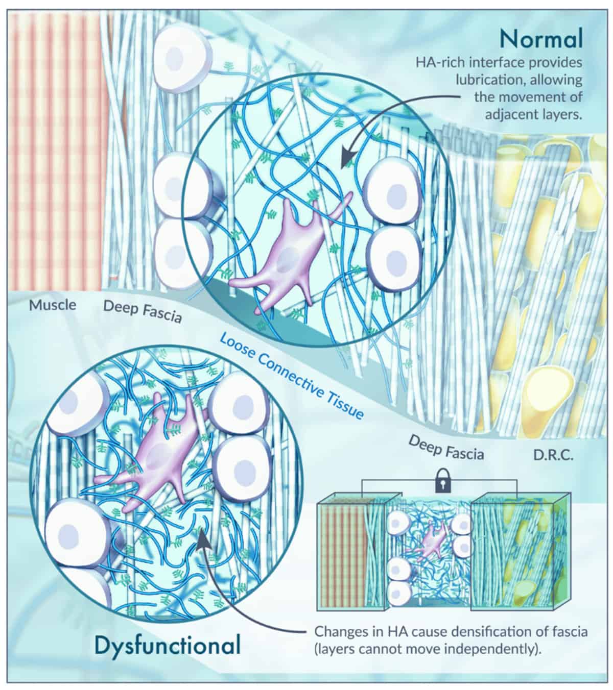 Dispelling the Myth: Manual Tissue Therapy Doesn’t Break Up Fascia – Vive