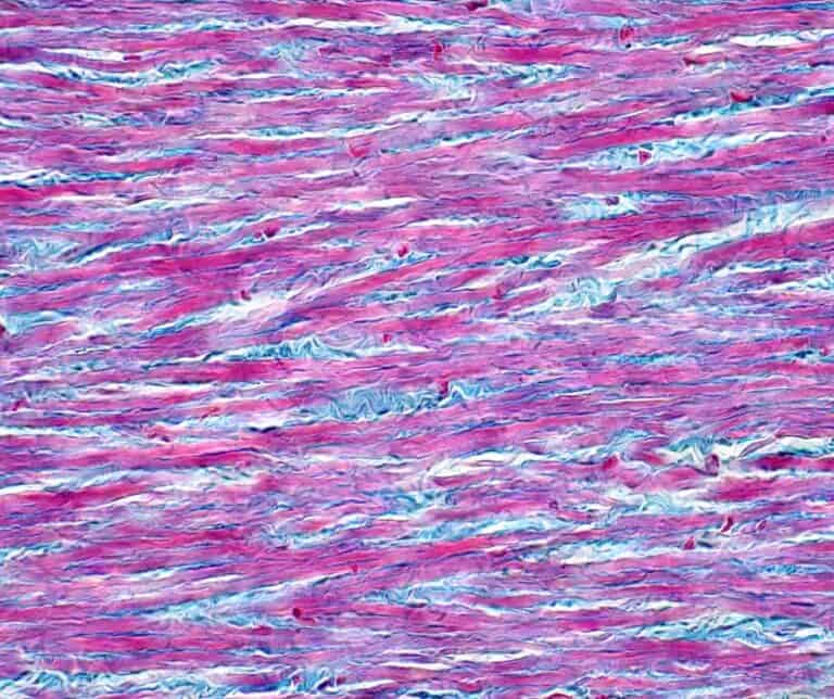 Understanding Densification and Fibrosis in Fascia – Vive